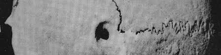 Successful skull trepanation in Neolithic China – Novo Scriptorium
