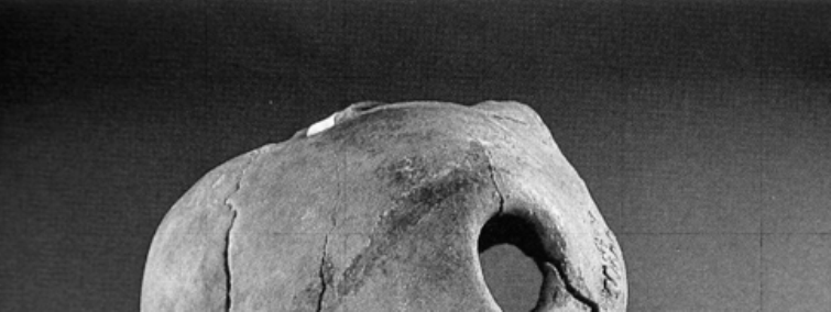 Successful skull trepanation in Neolithic China – Novo Scriptorium