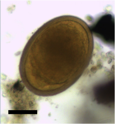 Ancient faeces reveal parasites described in earliest Greek medical ...