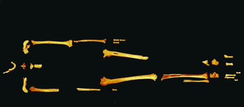 The Tianyuan Cave man; the earliest (40,000 yBP) ancient DNA from East ...
